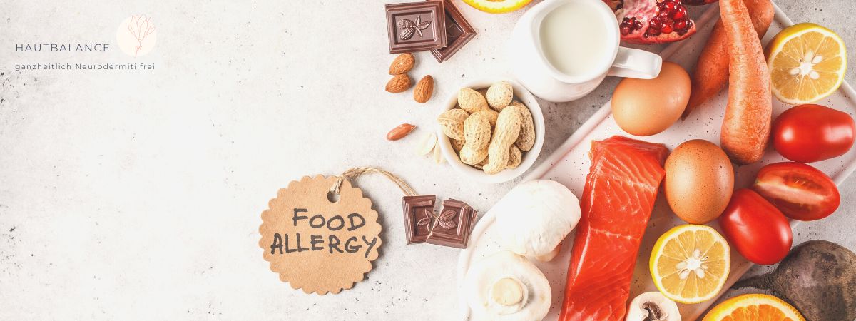 In 6 Schritten rausfinden, gegen was du allergisch bist - Sarah Knott